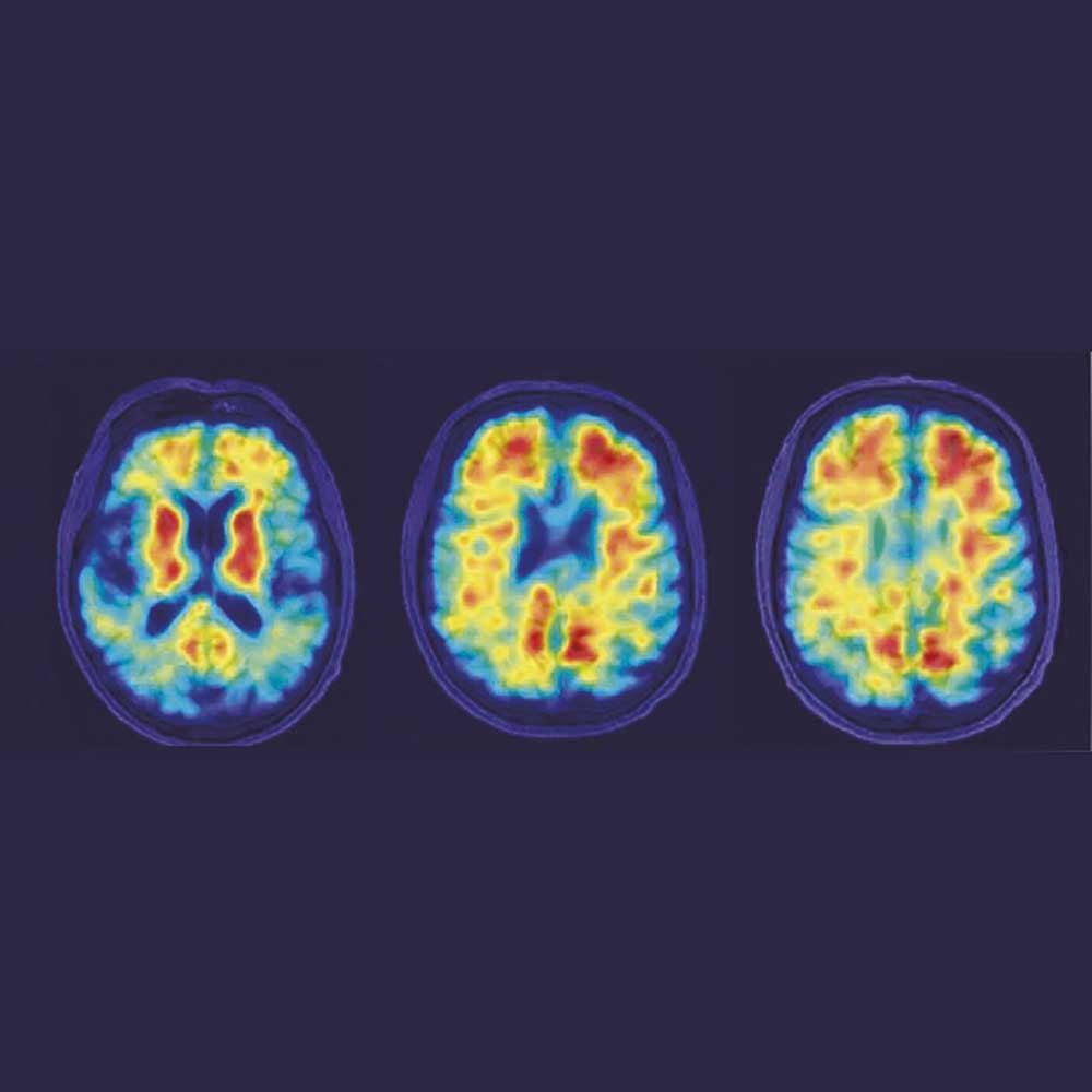 Lucy Memory Power (30 Capsules) | Easylife